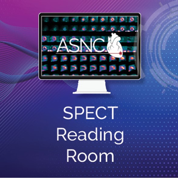 SPECT Virtual Reading Room